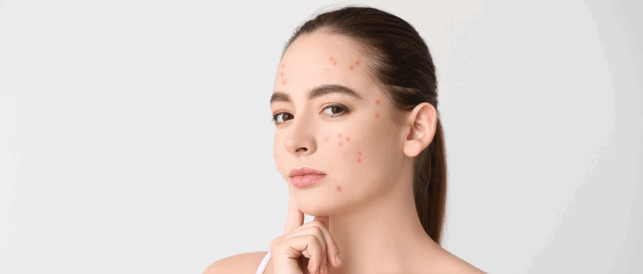 Reduce Facial Redness Naturally: Proven Tips That Work | Adore Skin Clinic