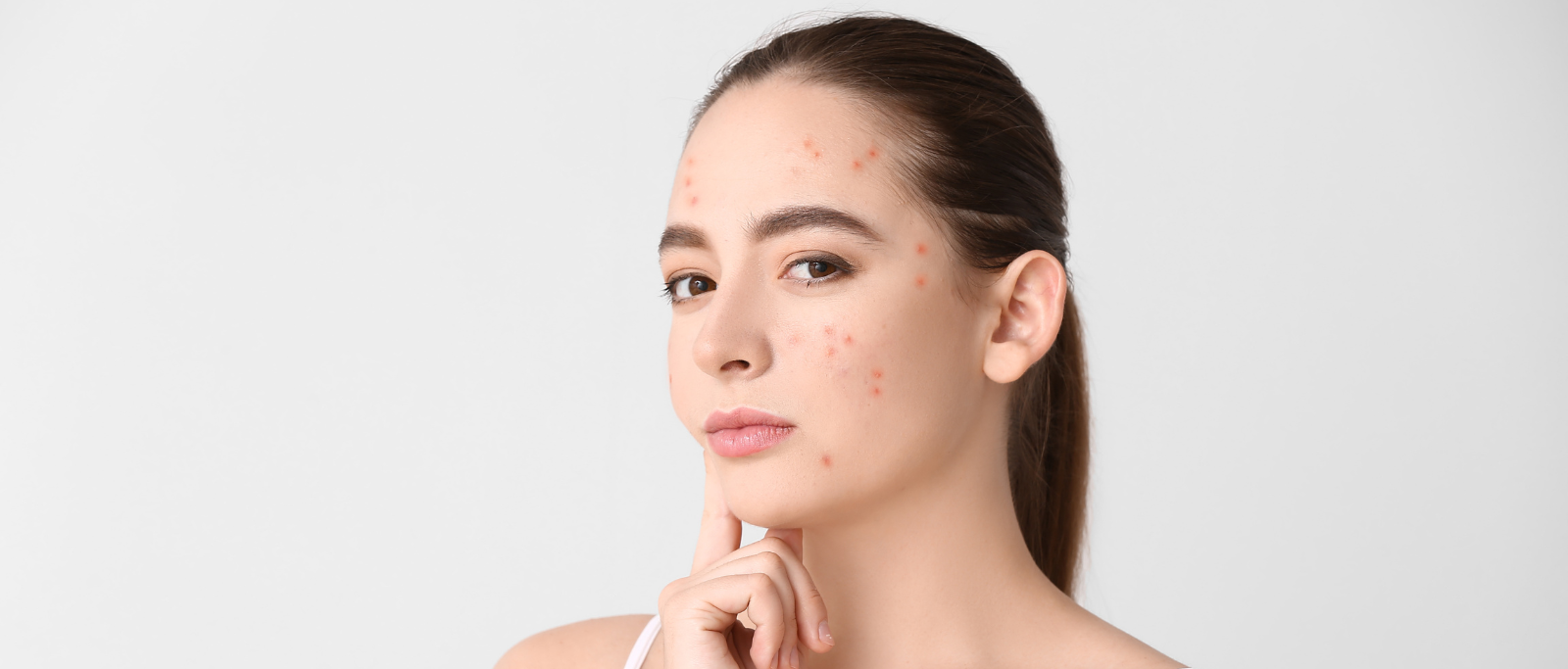 Reduce Facial Redness Naturally: Proven Tips That Work | Adore Skin Clinic